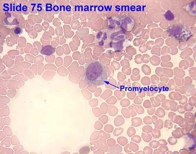 Hematopoiesis